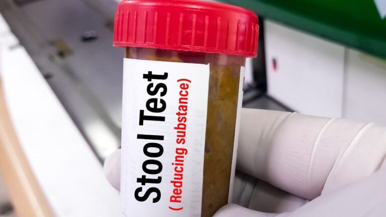 How to Collect Cat Stool Sample: A Step-by-Step Guide