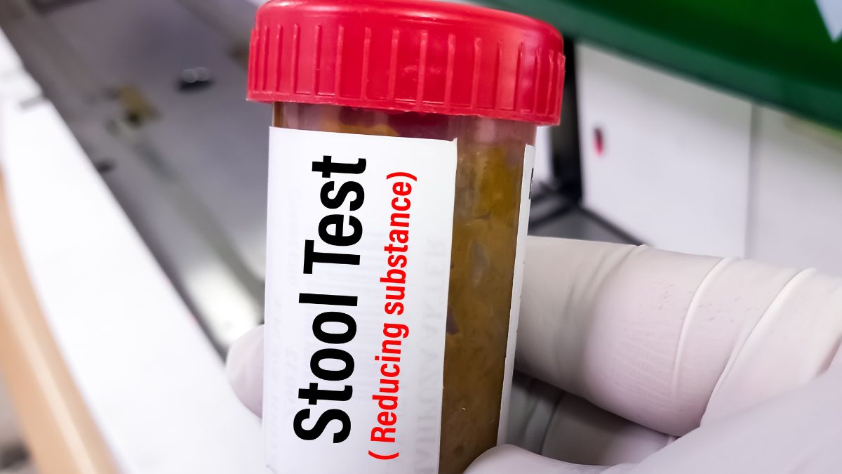 How to Collect Cat Stool Sample: A Step-by-Step Guide