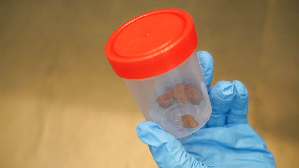 How to Collect Cat Stool Sample: A Step-by-Step Guide